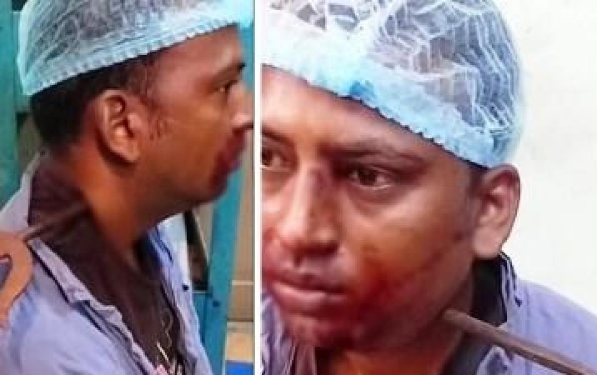 Homem briga com colegas e acaba com tridente de 150 anos atravessado no ...